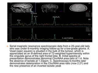 MRI spectroscopy- Its Application, Principle & Techniques | PPTX
