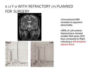 MRI spectroscopy- Its Application, Principle & Techniques | PPTX