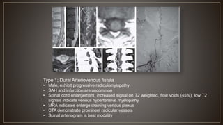 Radiology of Spine | PPTX