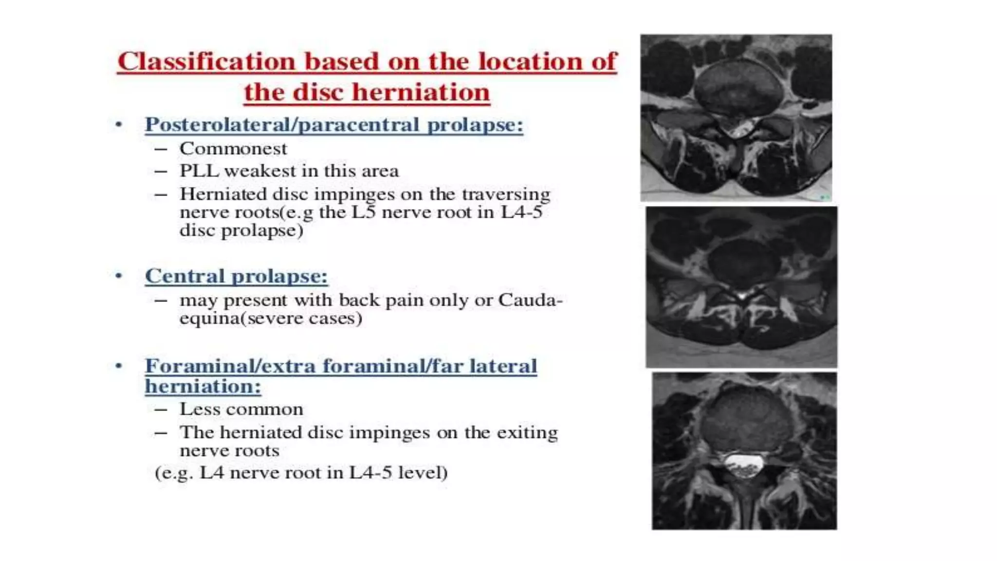 MRI SPINE ANATOMY | PPTX