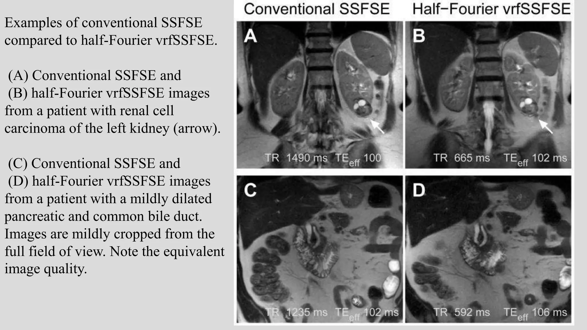 Mri spin echo pulse sequences its variations and | PPTX | Geology | Science