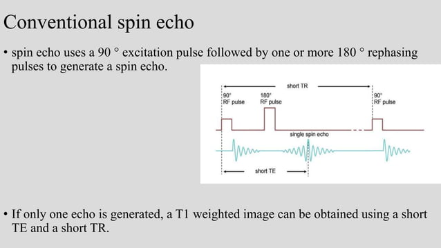 Mri spin echo pulse sequences its variations and | PPTX | Geology | Science