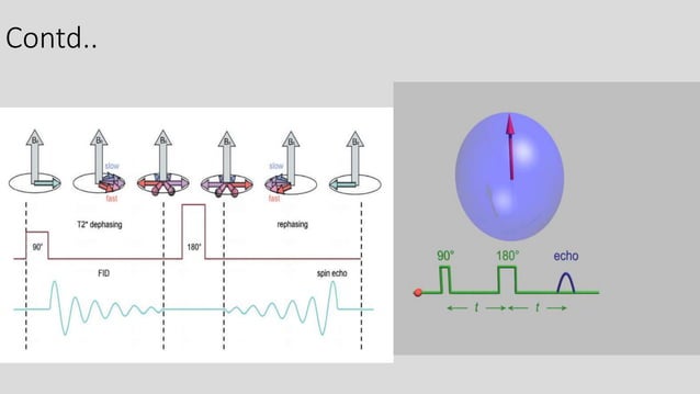 Mri spin echo pulse sequences its variations and | PPTX | Geology | Science