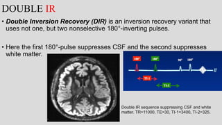 Inversion Recovery Spin Echo Pulse Sequence