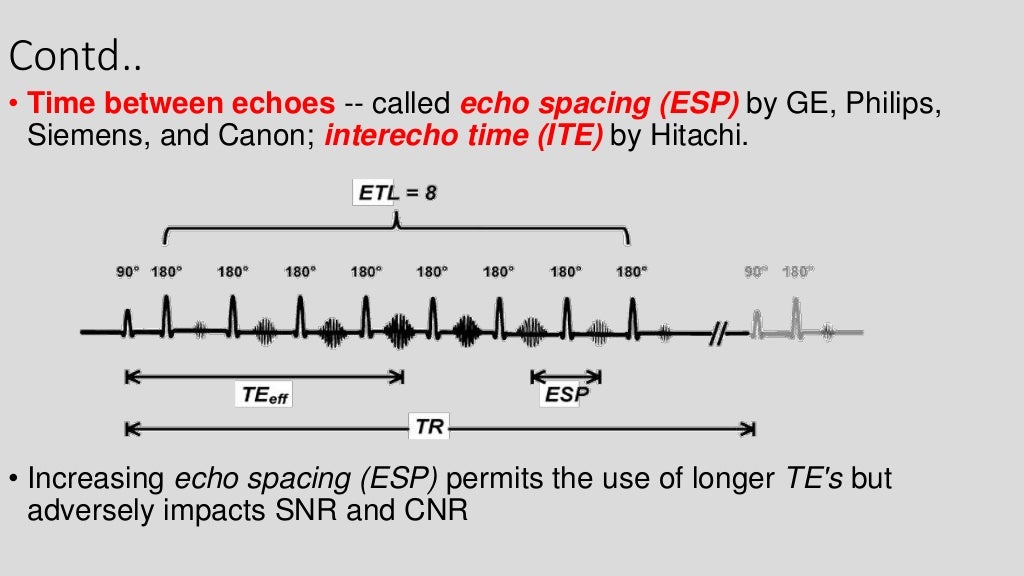 Mri spin echo pulse sequences its variations and