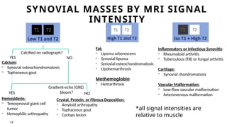 MRI signal intensity approach to synovial masses | PPTX