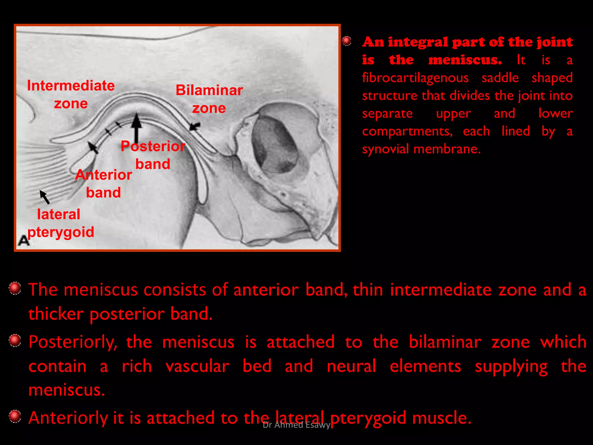 MRI TMJ temporo mandibular jiont Dr Ahmed Esawy | PDF