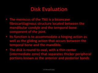 MRI TMJ temporo mandibular jiont Dr Ahmed Esawy | PDF