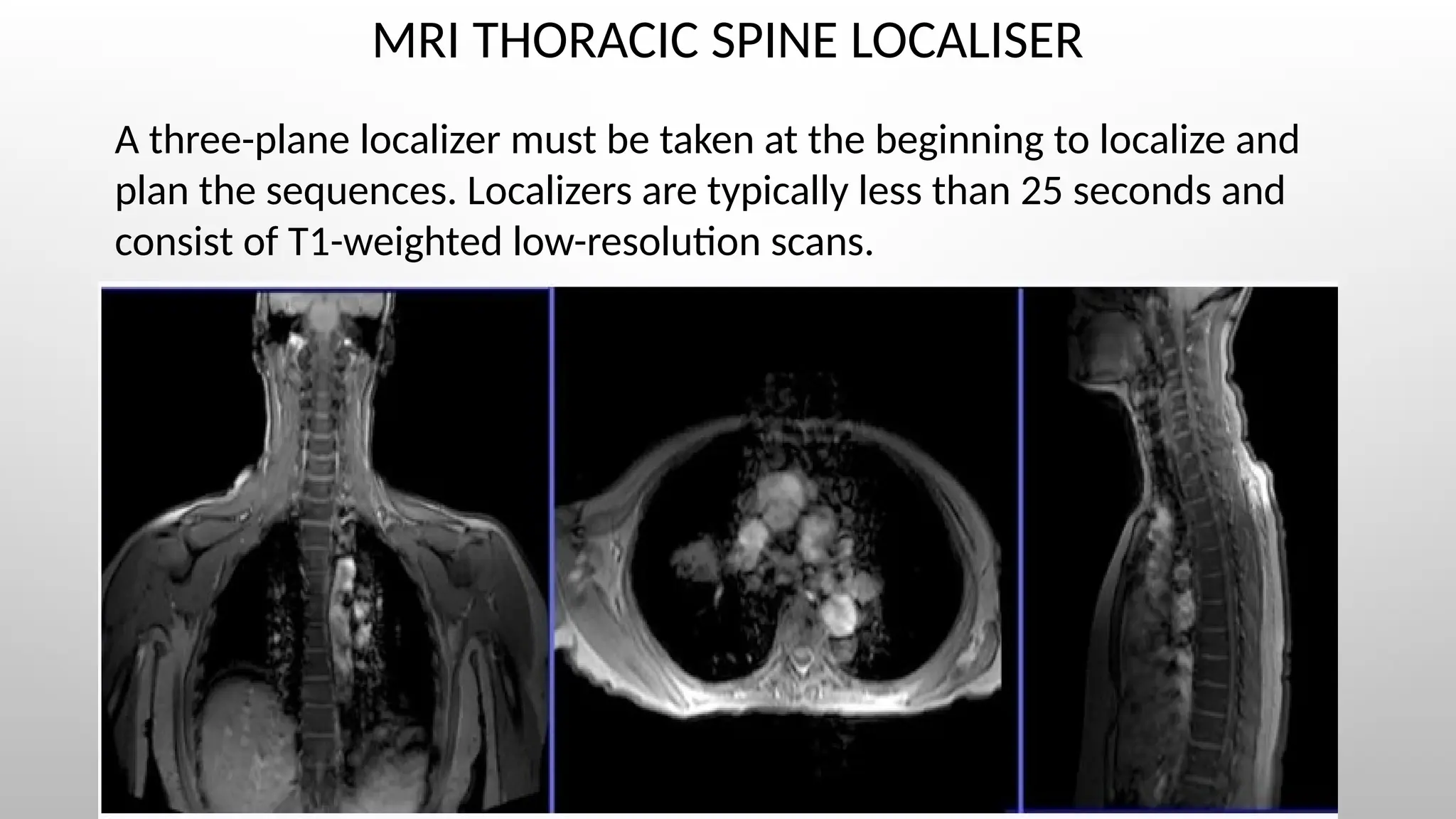 Magnetic Imaging Resonance TOTAL SPINE....pptx