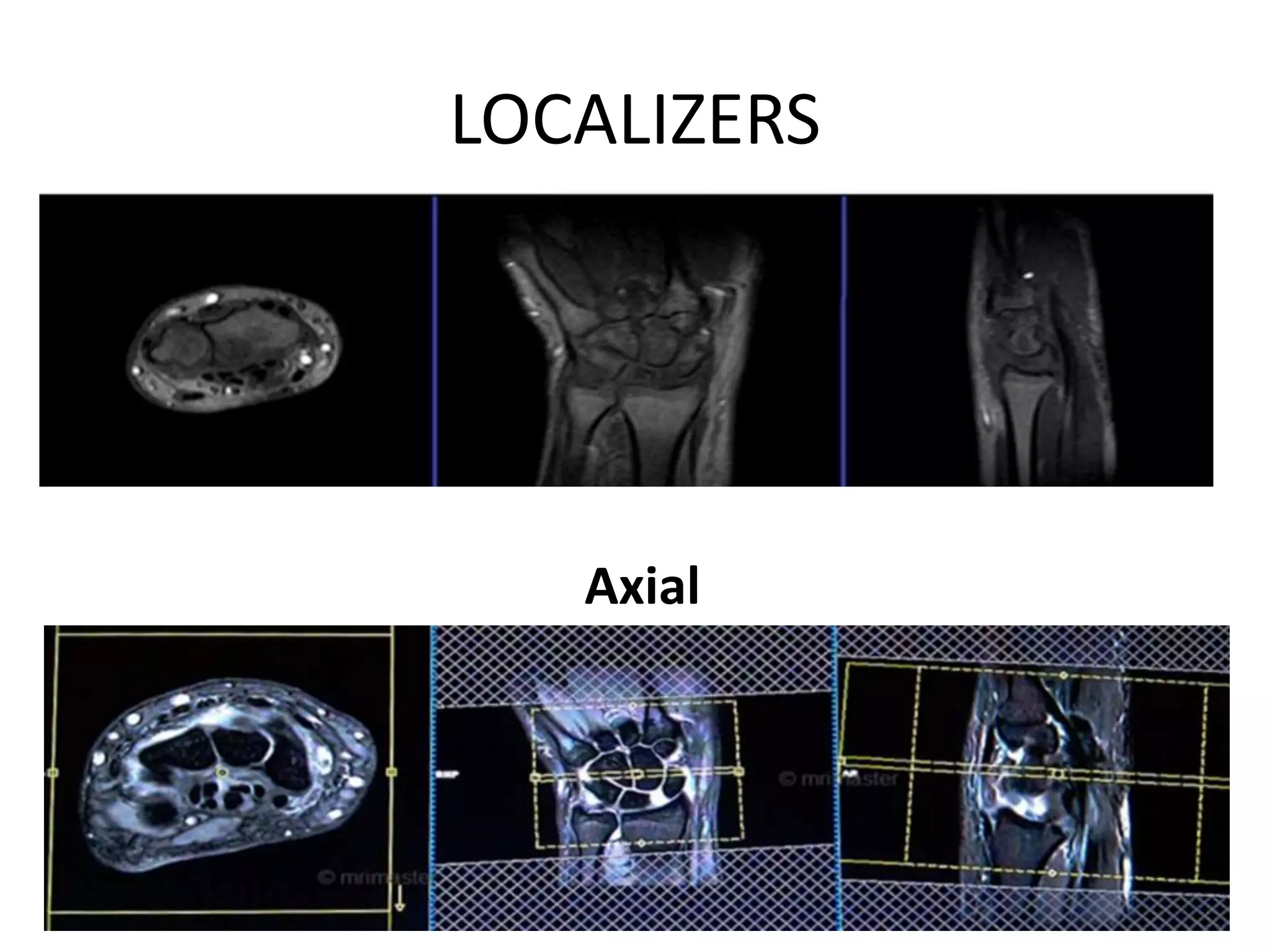 MRI WRIST SCAN PLANE AND LOCATION | PPTX