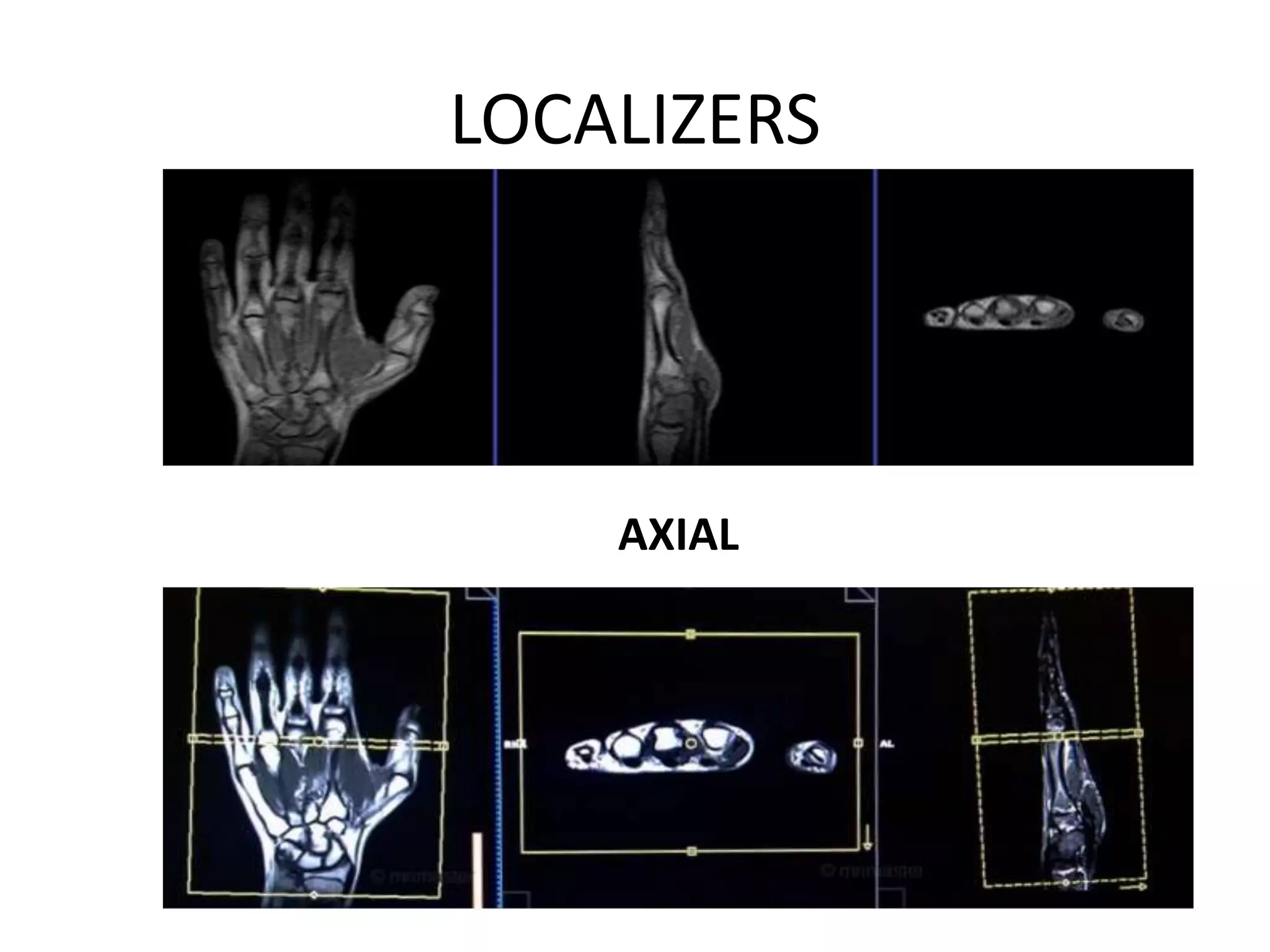 MRI WRIST SCAN PLANE AND LOCATION | PPTX