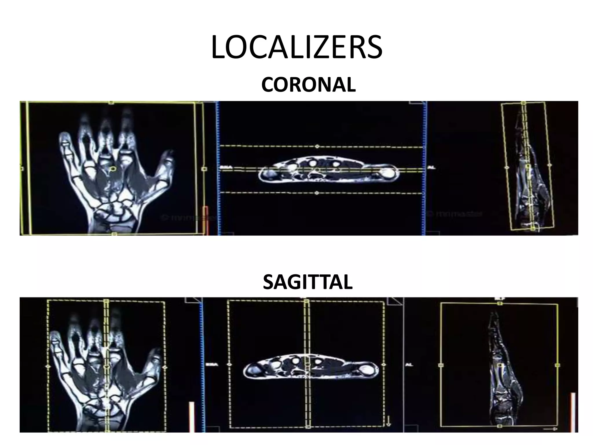 MRI WRIST SCAN PLANE AND LOCATION | PPTX