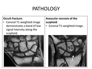 MRI WRIST SCAN PLANE AND LOCATION | PPTX