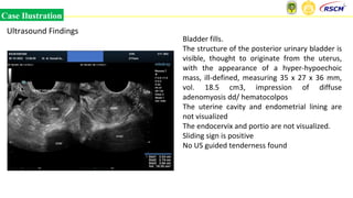 Mayor rokinstanksy KH Syndrome case presentation type 2 | PPTX