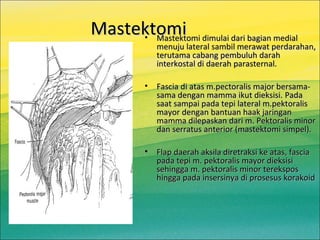 Modified Radical Mastectomy MRM aai | PPT