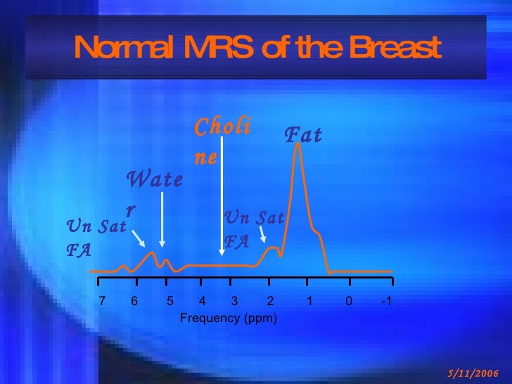 Mr Mammography New