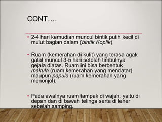 imunisasi measles rubella indonesia puskesmas | PPT