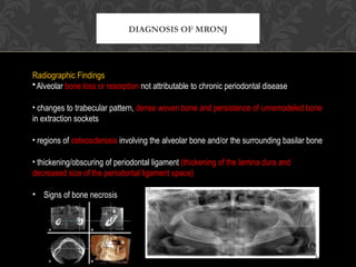 MRONJ - medical related osteonecrosis of the jaw .pptx