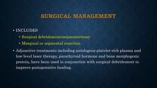 Mronj ppt | PPTX