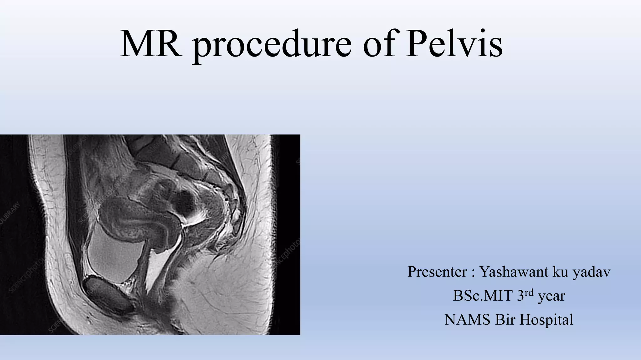 Mr procedure of pelvis and hip joint | PPTX
