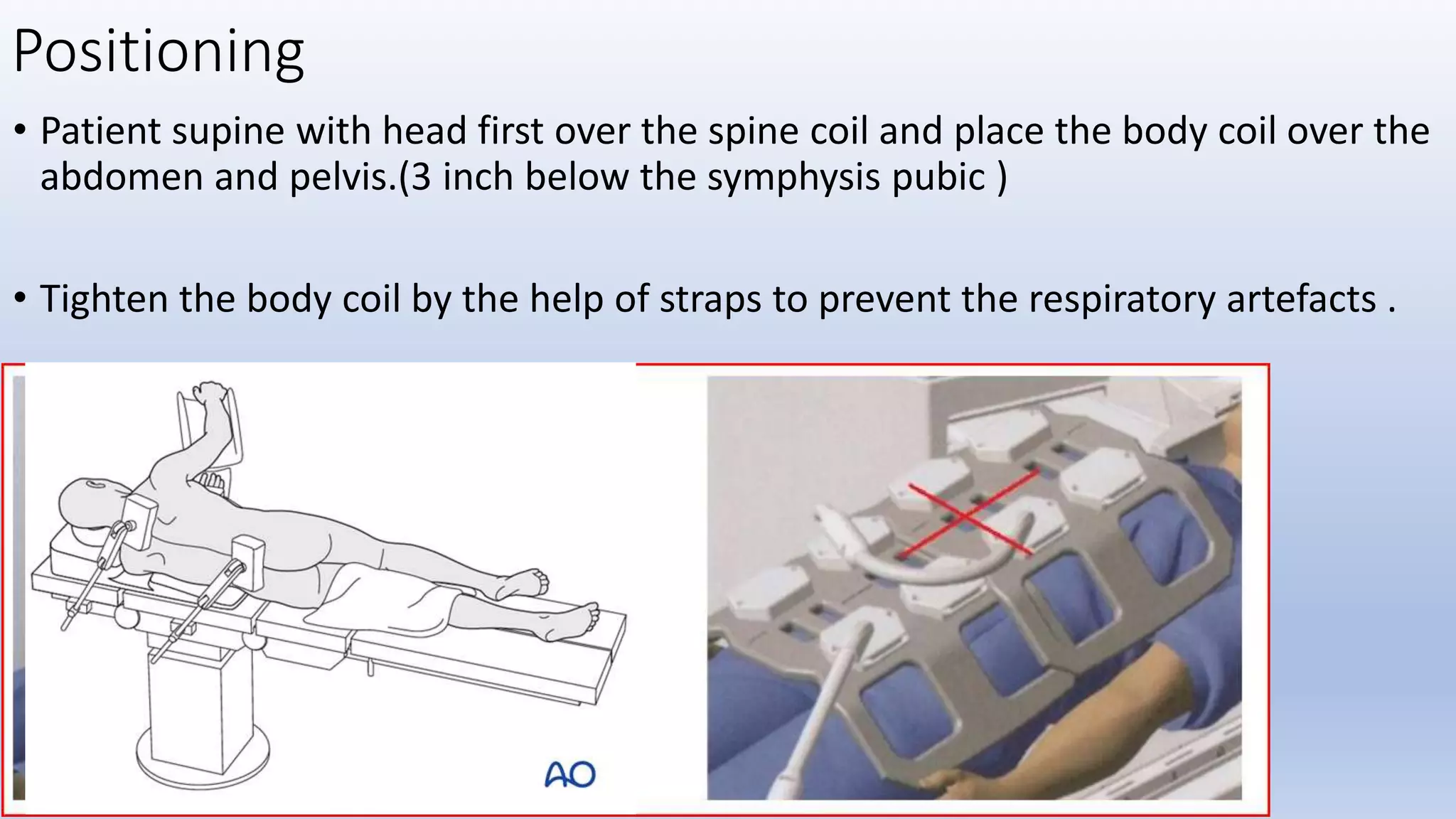 Mr procedure of pelvis and hip joint | PPTX