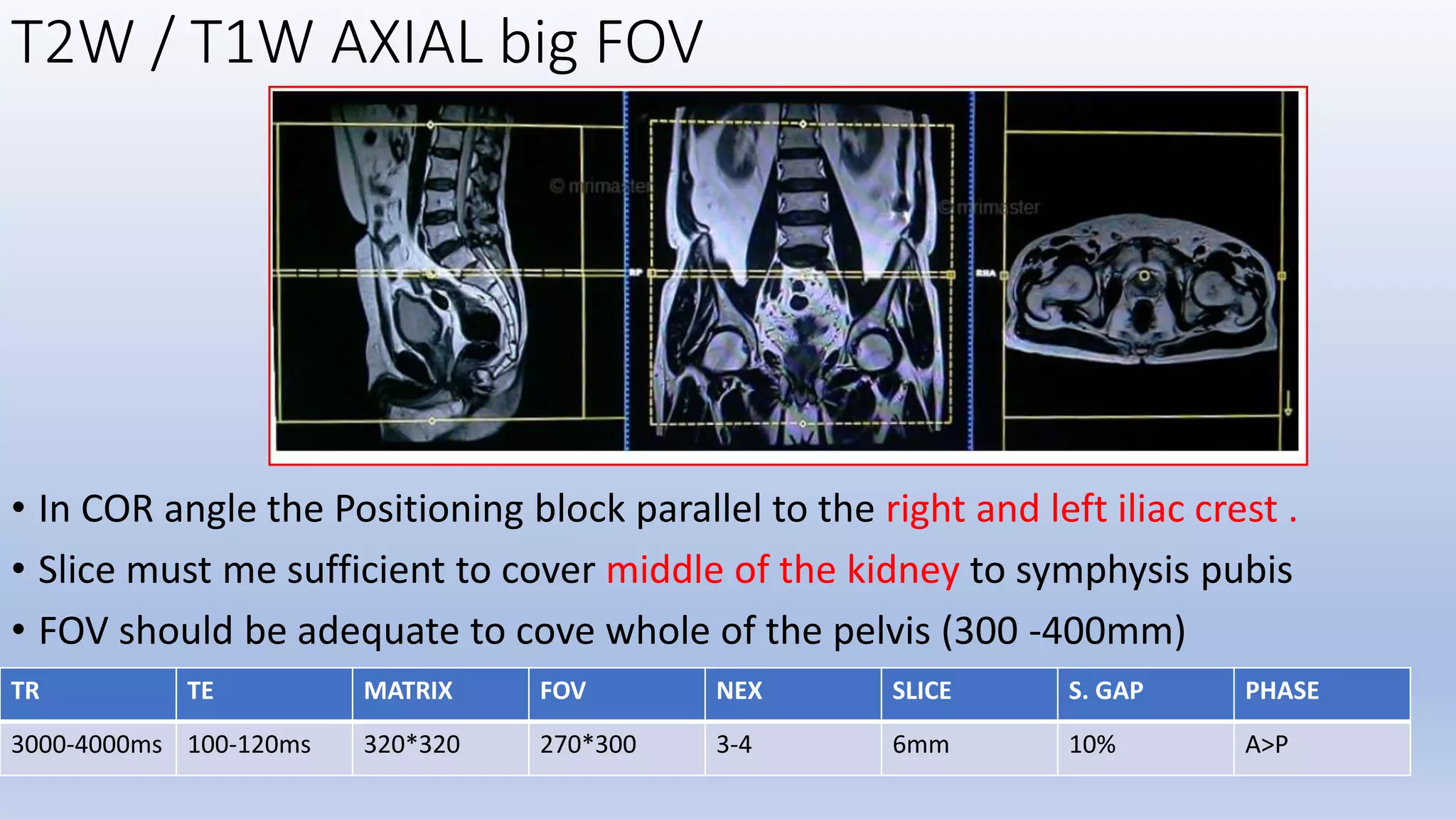 Mr procedure of pelvis and hip joint | PPTX