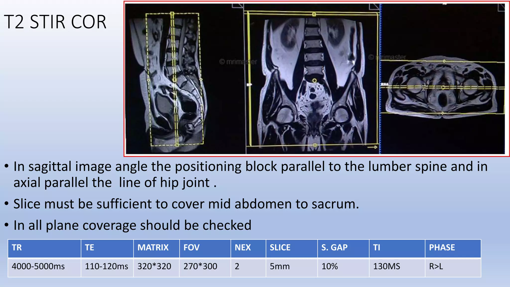 Mr procedure of pelvis and hip joint | PPTX