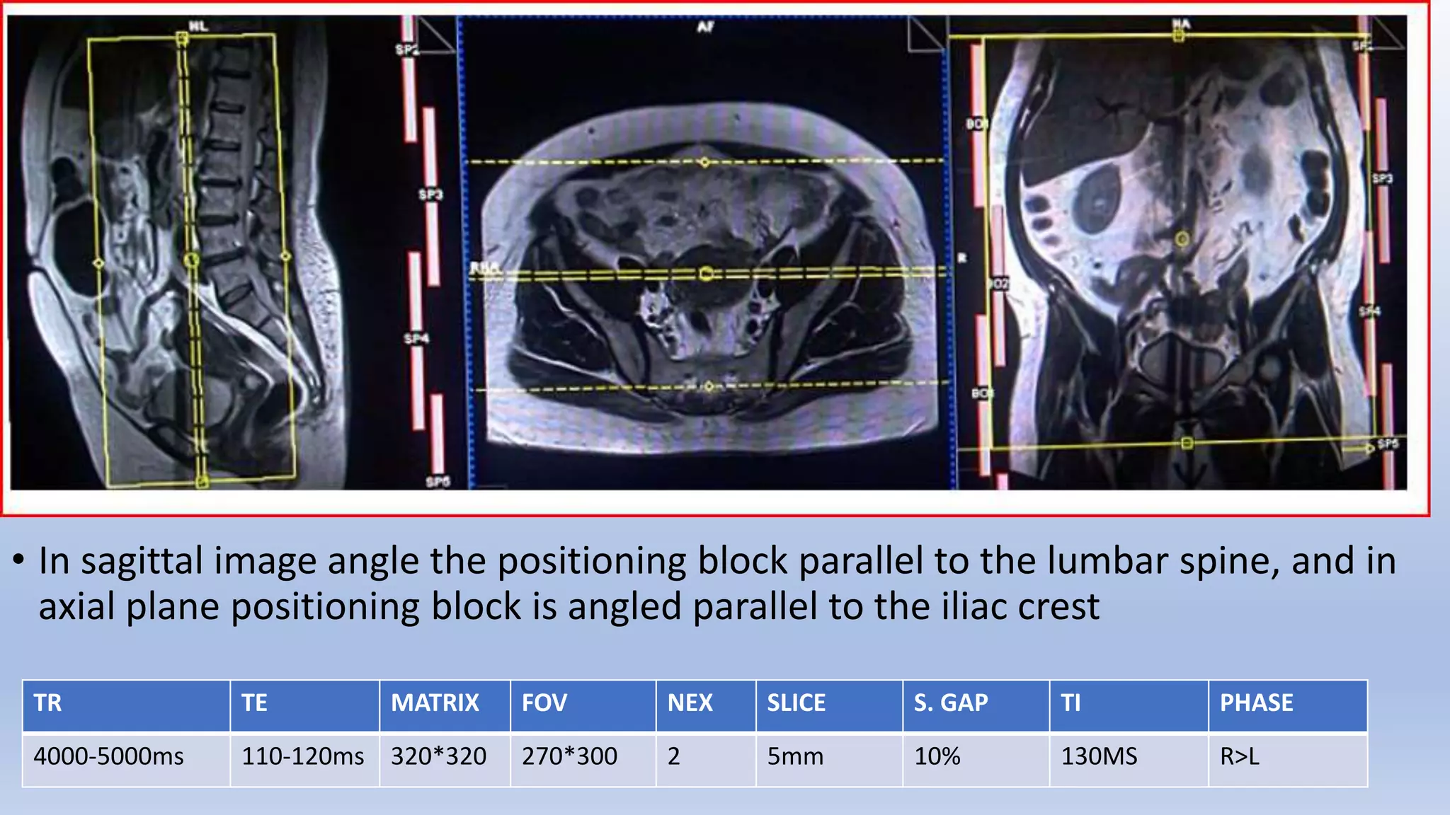 Mr procedure of pelvis and hip joint | PPTX