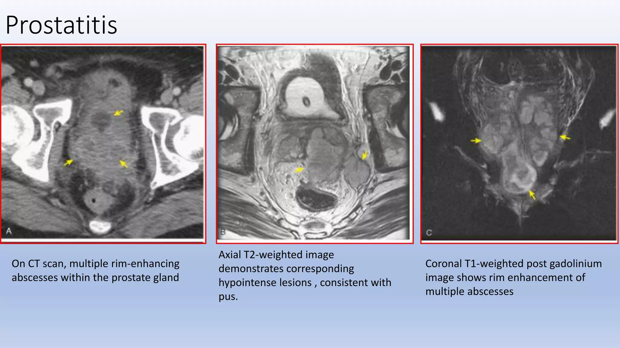 Mr procedure of pelvis and hip joint | PPTX