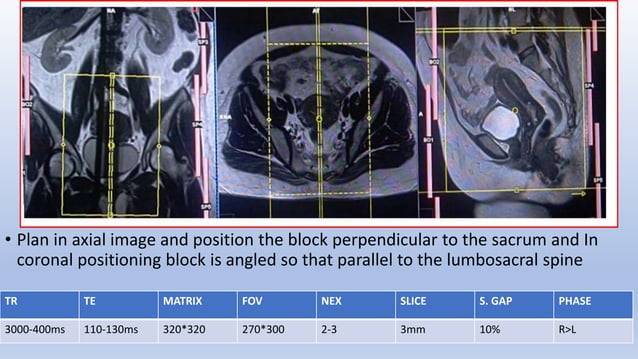 Mr procedure of pelvis and hip joint | PPTX | Pregnancy | Reproductive ...