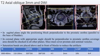 Mr procedure of pelvis and hip joint | PPTX