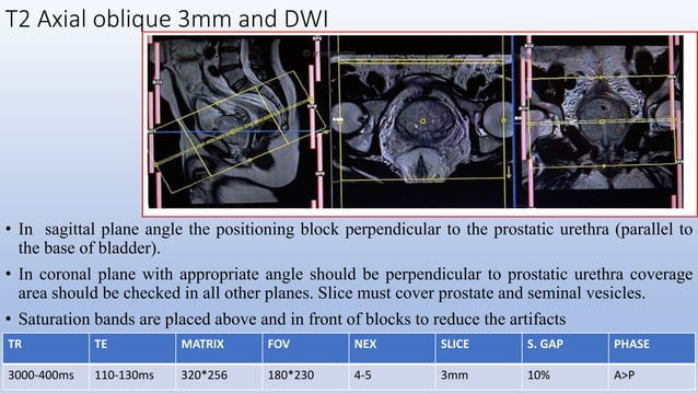 Mr procedure of pelvis and hip joint | PPTX | Pregnancy | Reproductive ...