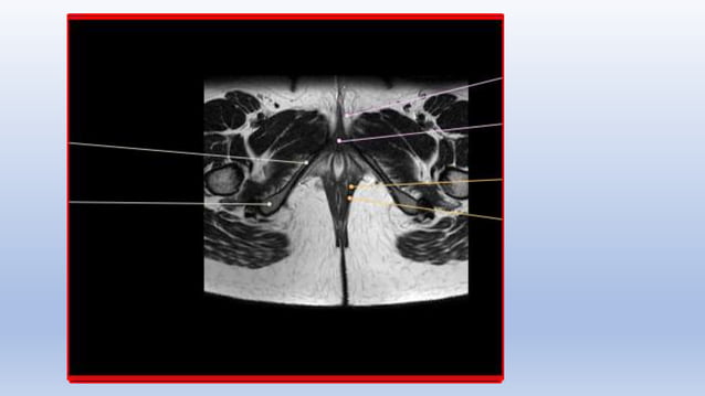 Mr procedure of pelvis and hip joint | PPTX | Pregnancy | Reproductive ...