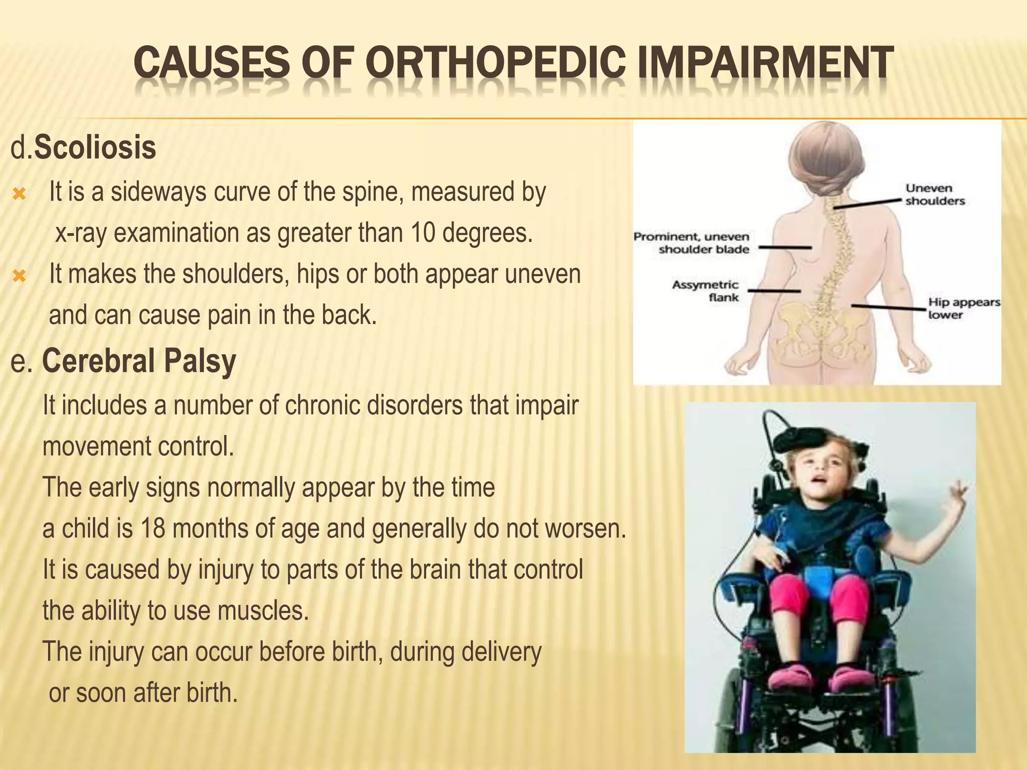 Orthopedic impairment | PPT