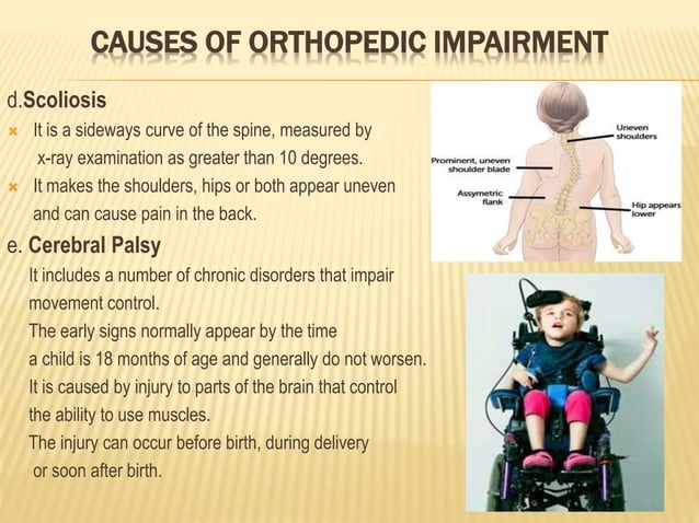 Orthopedic impairment | PPTX | Brain and Nervous System Disorders ...