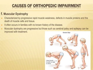 Orthopedic impairment | PPTX