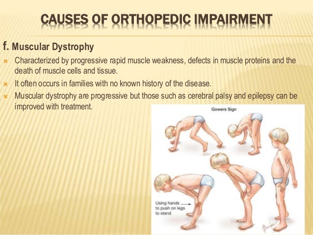 Orthopedic impairment