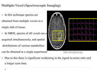 Magnetic Resonance Spectroscopy | PPTX