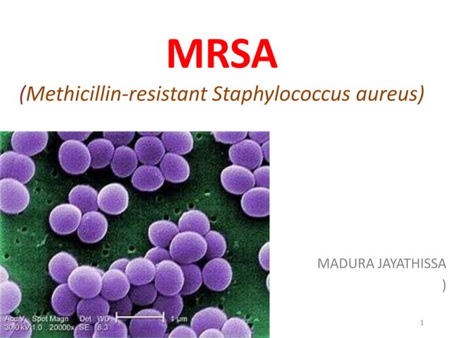 Mrsa | PPSX