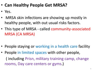 Mrsa | PPSX