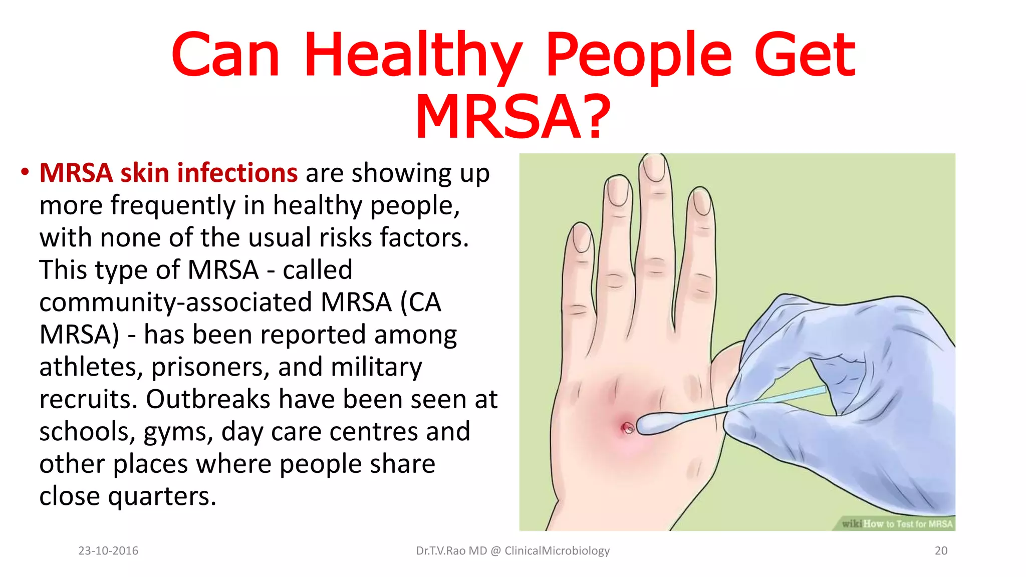 Screening for MRSA | PPTX