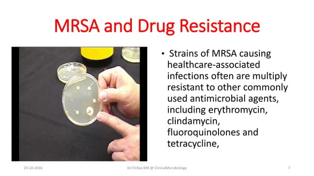 Screening for MRSA | PPTX | Infectious Diseases | Diseases and Conditions