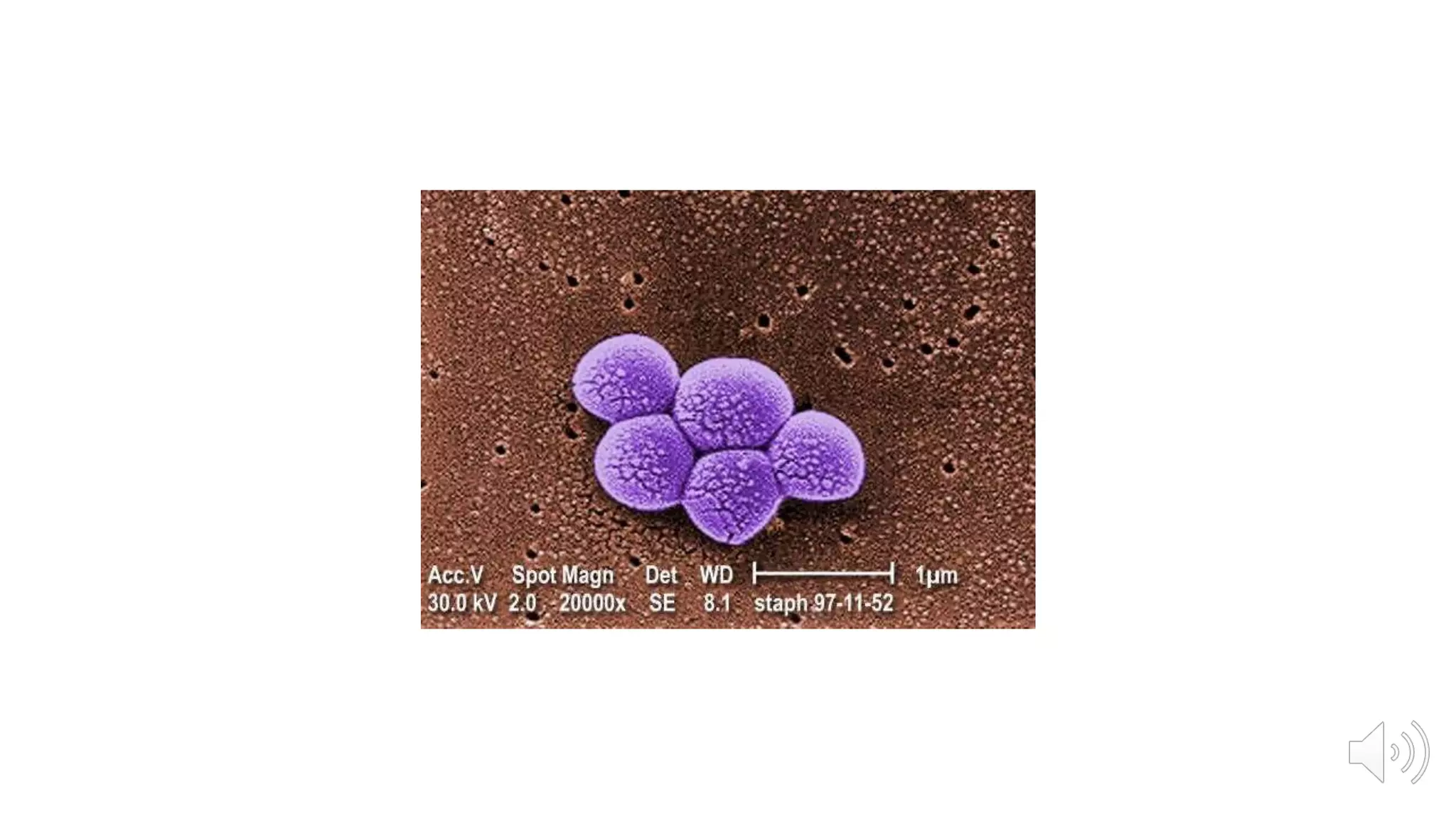 My Favorite Microbe: MRSA | PPT