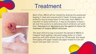 MRSA .pptx