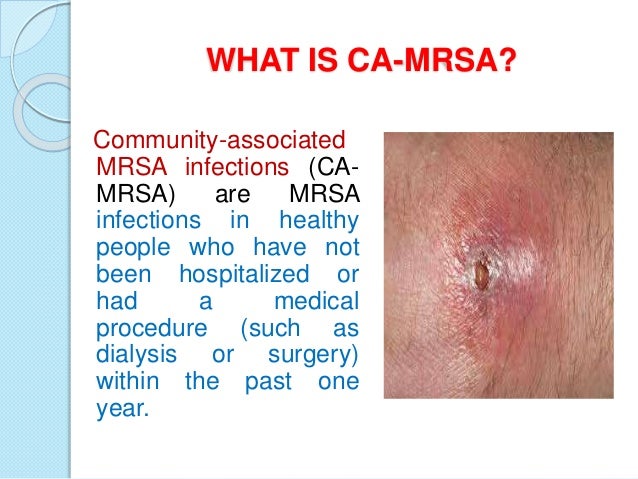 MRSA AN UPDATE