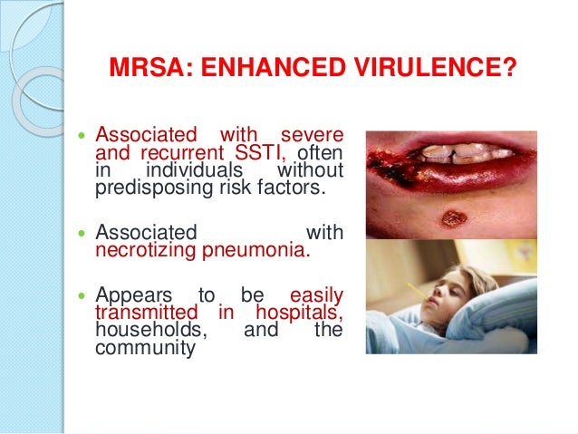 MRSA AN UPDATE