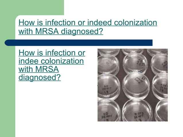 Mrsa ppt | PPT