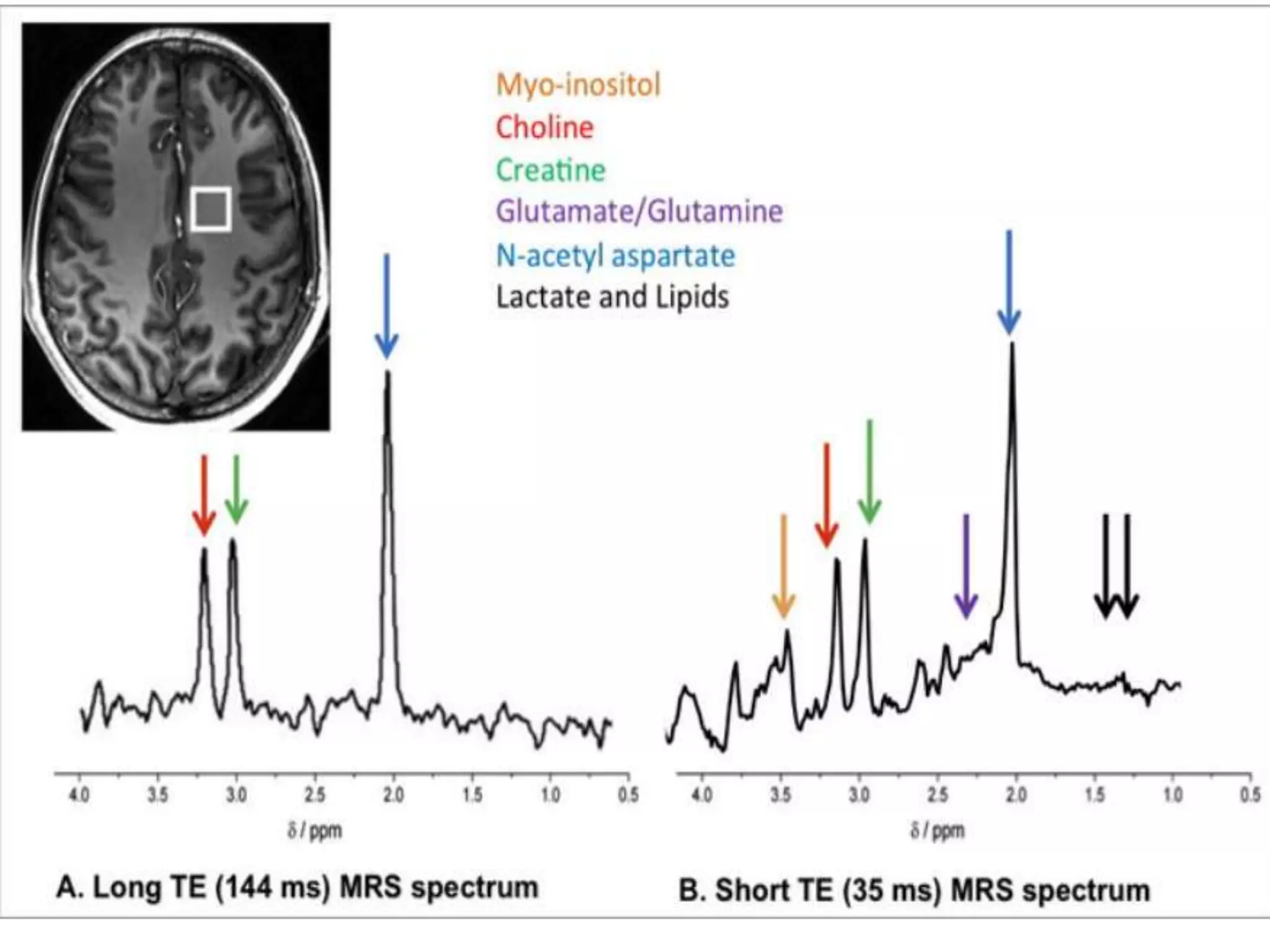 Mrs basic principles and clinical applications of magnetic resonance ...