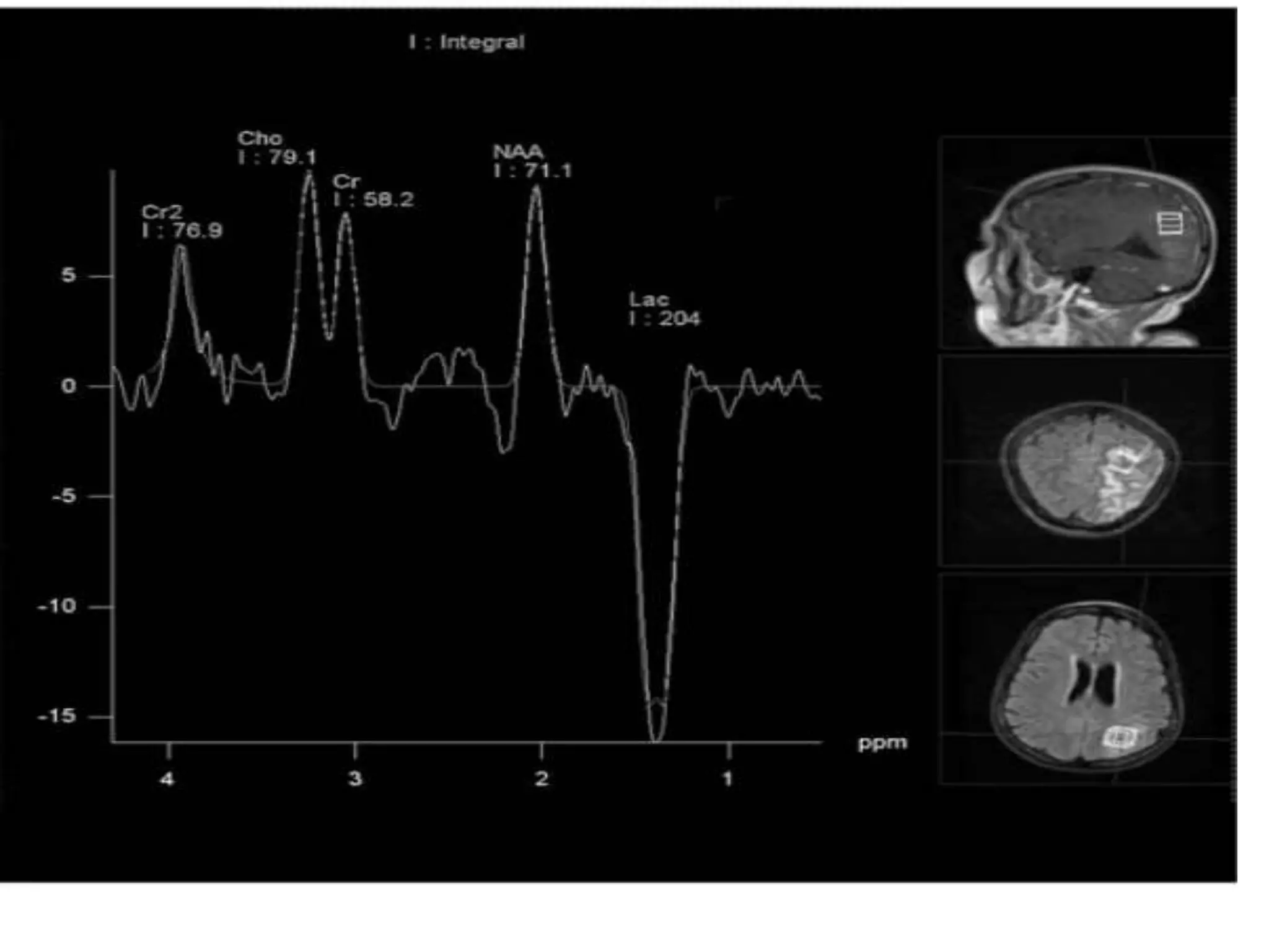 Mrs basic principles and clinical applications of magnetic resonance ...