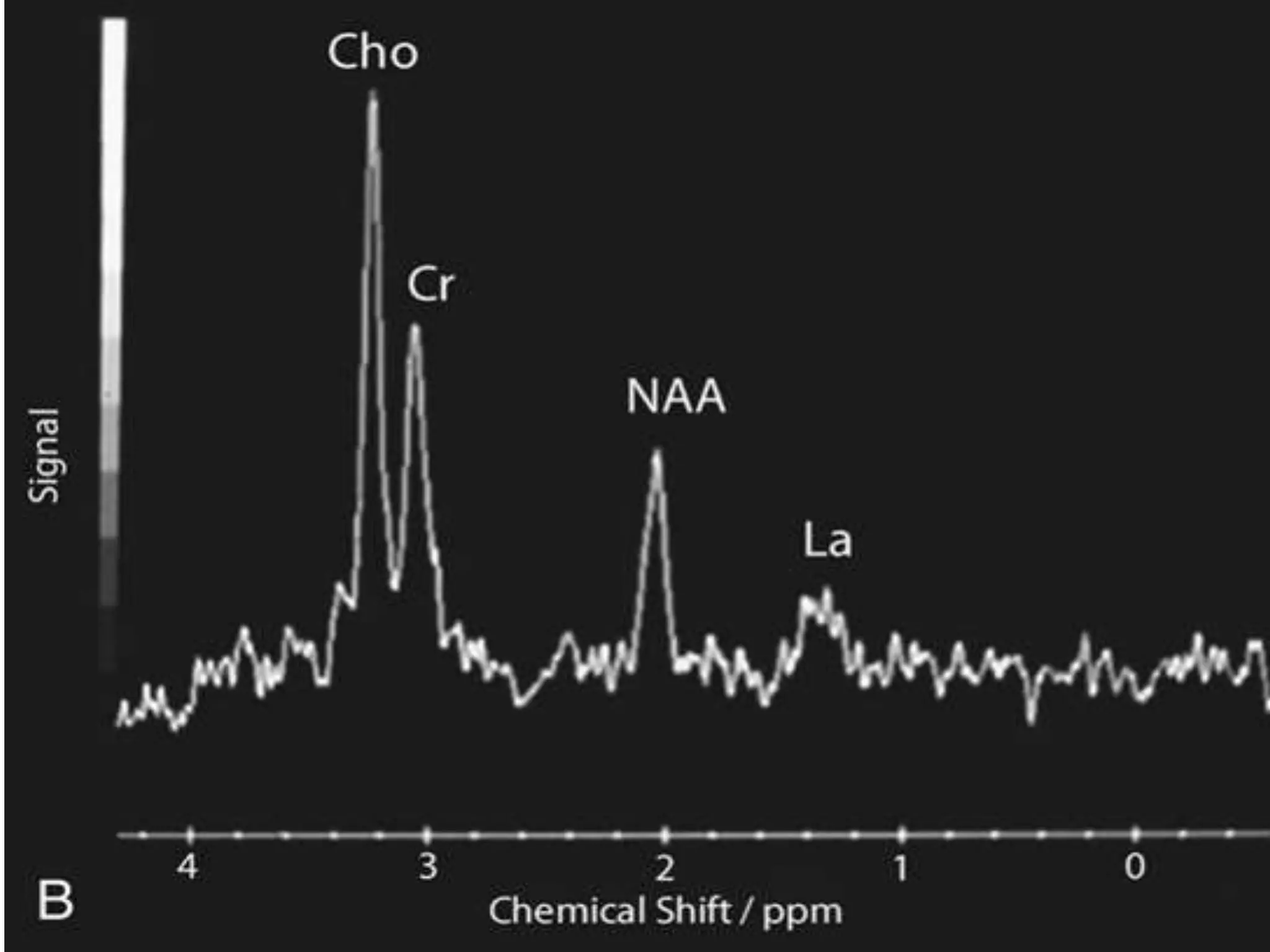 Mrs basic principles and clinical applications of magnetic resonance ...